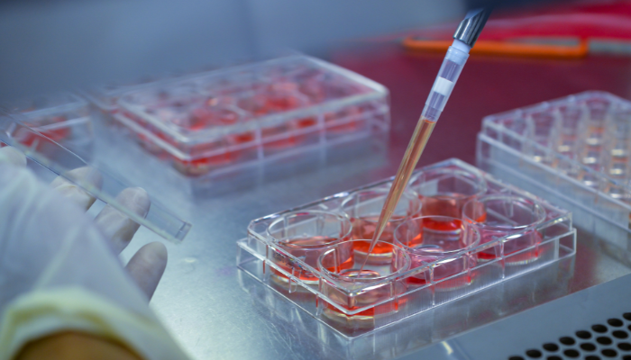 Serology Testing | Health Monitoring